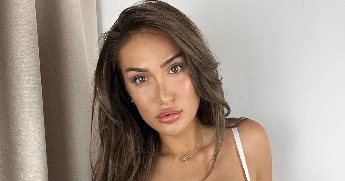 Luna Skye dévoile et assume ses cicatrices sur les fesses après son ...