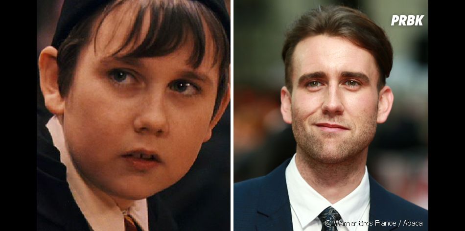 Matthew Lewis : son avant/après impressionnant - Purebreak