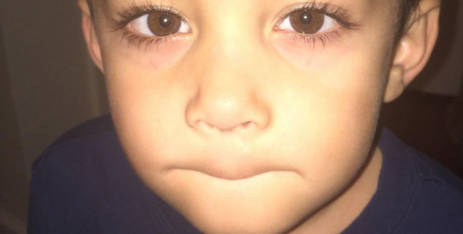 Ayden Benesh et sa blessure au front - Purebreak